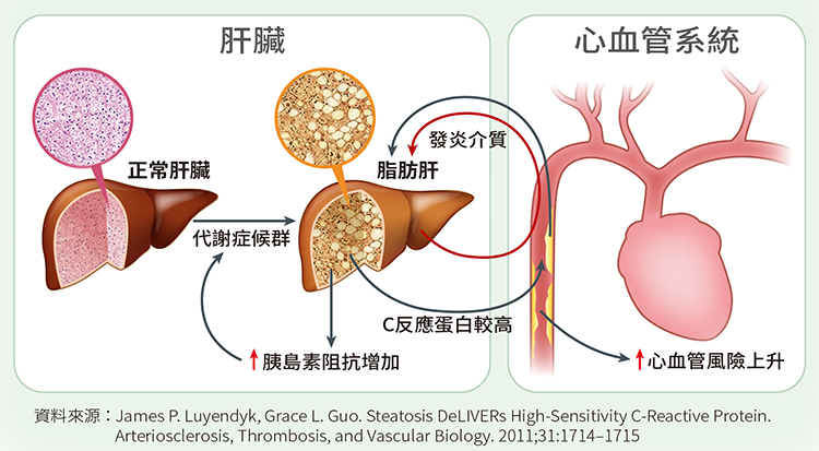 共同照護「心」「肝」寶貝！ 同為代謝異常問題 有脂肪肝也會「傷心」 - Heho健康